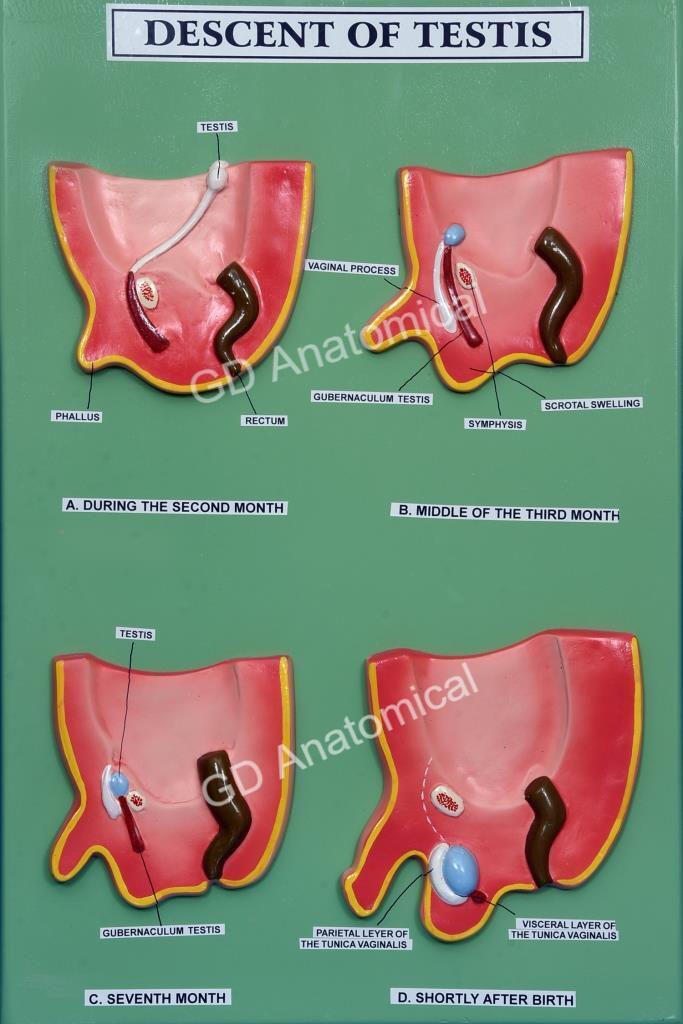 Descent Of Testis Model