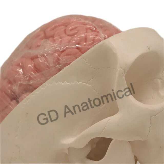 Human Skull With Brain