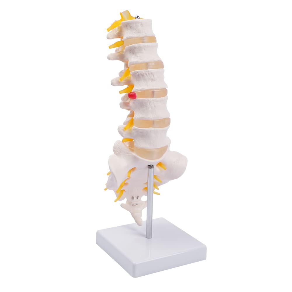 Lumbar Vertebral Column With Sacrum And Spinal Nerves Anatomy Model
