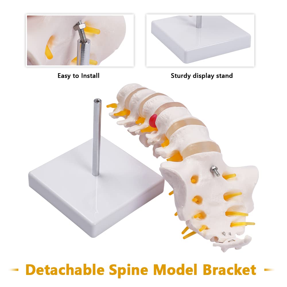 Lumbar Vertebral Column With Sacrum And Spinal Nerves Anatomy Model