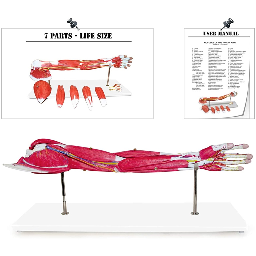 Muscles Of Arm With Main Vessels And Nerves