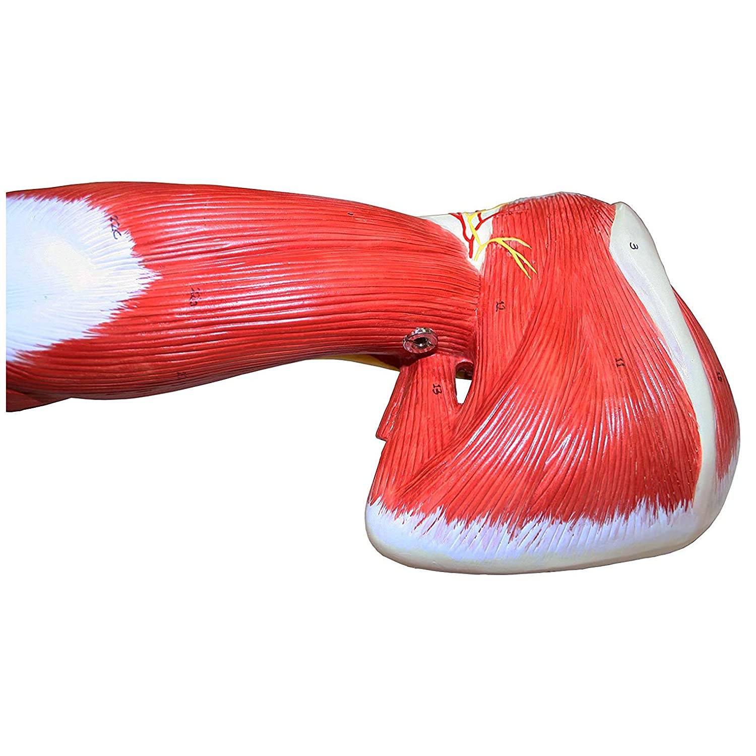 Muscles Of Arm With Main Vessels And Nerves